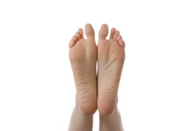 What are Orthotics and how can they help Foot, Back, and Knee pain?